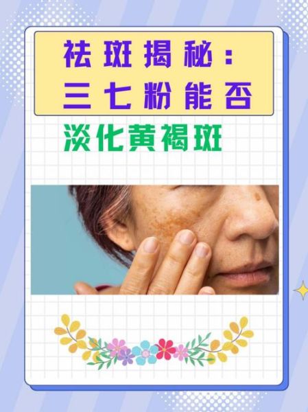 三七粉能祛斑吗_三七粉去黄褐斑效果怎么样-第1张图片-山城妙识 三七粉能祛斑吗_三七粉去黄褐斑效果怎么样-第1张图片-山城妙识