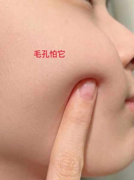 猪油膏会堵塞毛孔吗_油皮能用猪油膏吗-第1张图片-山城妙识