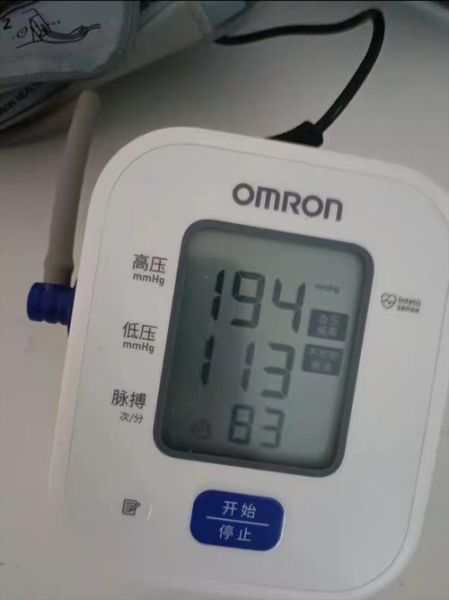 血压150 100严重吗_血压150 100有危险吗-第3张图片-山城妙识