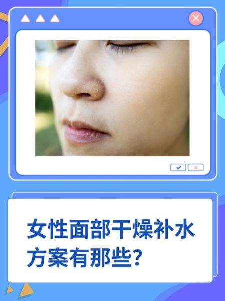 脸干补水最好土方法_脸干怎么快速补水-第1张图片-山城妙识