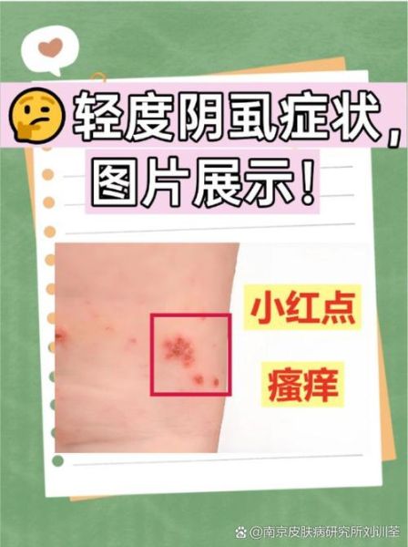 虱怎么读_虱子读音是什么-第2张图片-山城妙识 虱怎么读_虱子读音是什么-第2张图片-山城妙识