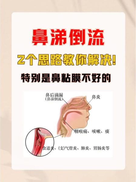 感冒流鼻涕怎么办_鼻塞小偏方真的有用吗-第1张图片-山城妙识