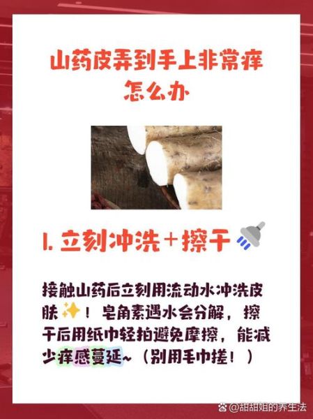 芋头过敏手痒怎么办_快速止痒小妙招-第3张图片-山城妙识