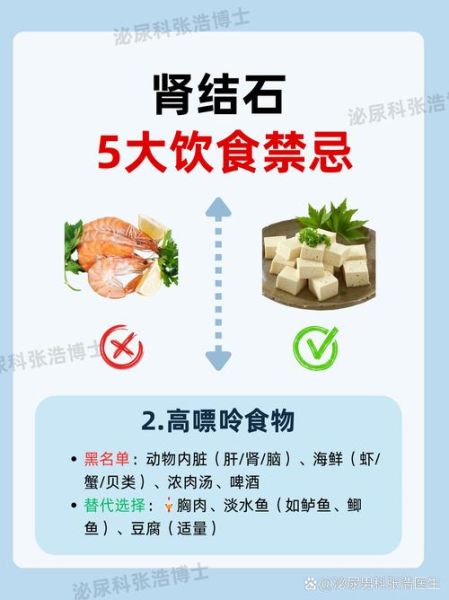 肾结石饮食注意哪些方面_肾结石不能吃什么-第1张图片-山城妙识