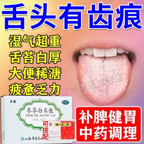 健脾祛湿吃什么药最好_脾虚湿气重怎么调理-第3张图片-山城妙识 健脾祛湿吃什么药最好_脾虚湿气重怎么调理-第3张图片-山城妙识