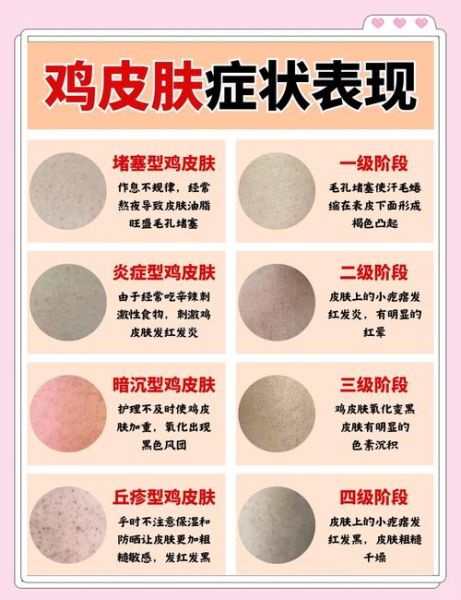 鸡皮肤图片手臂_怎么消除-第2张图片-山城妙识