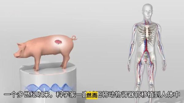 猪肾移植人体最新进展_猪肾移植人体能活多久-第2张图片-山城妙识 猪肾移植人体最新进展_猪肾移植人体能活多久-第2张图片-山城妙识