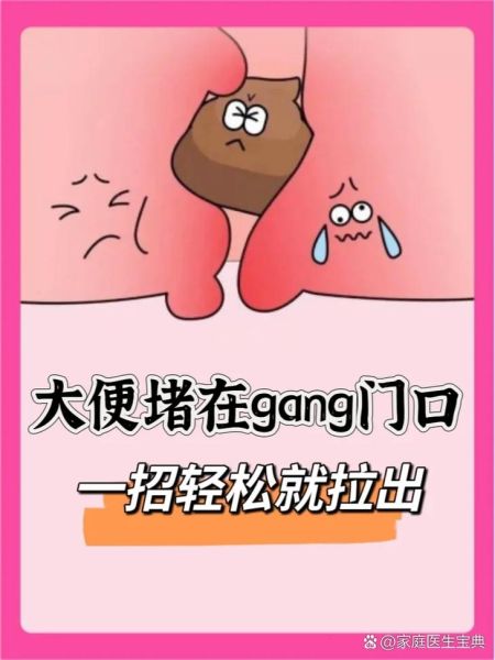 屎太硬已到肛门拉不出怎么办_如何快速软化-第1张图片-山城妙识 屎太硬已到肛门拉不出怎么办_如何快速软化-第1张图片-山城妙识