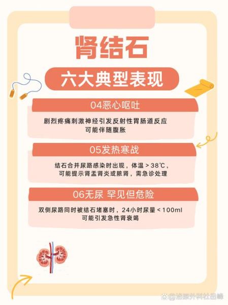 肾结石的早期症状_如何判断自己有肾结石-第1张图片-山城妙识 肾结石的早期症状_如何判断自己有肾结石-第1张图片-山城妙识