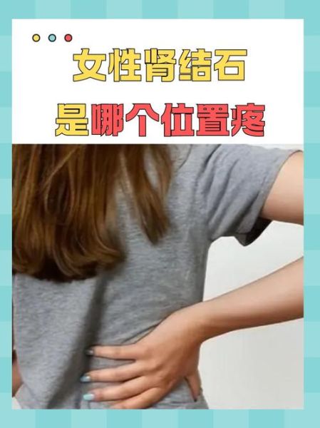 女性肾结石疼痛部位_女性肾结石哪里疼-第1张图片-山城妙识