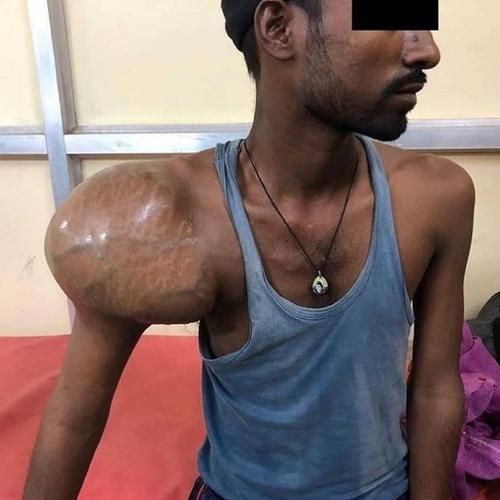 骨肉瘤早期症状有哪些_骨肉瘤早期症状图片-第1张图片-山城妙识 骨肉瘤早期症状有哪些_骨肉瘤早期症状图片-第1张图片-山城妙识