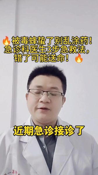 马蜂有毒吗_被马蜂蛰了怎么办-第1张图片-山城妙识