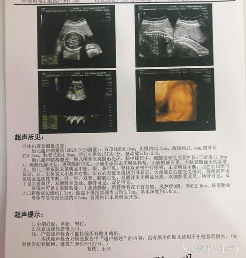 大排畸检查多少钱_大排畸价格是多少-第2张图片-山城妙识