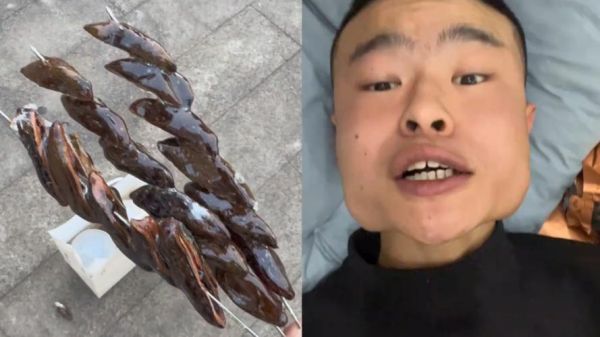 长期吃槟榔的人脸部变化_槟榔脸还能恢复吗-第2张图片-山城妙识