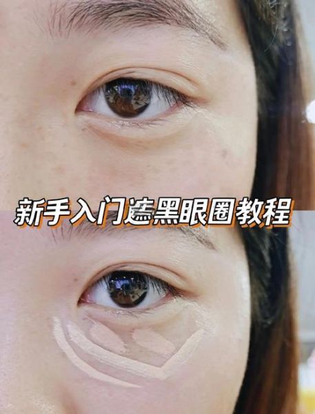 怎么消除黑眼圈最有效_黑眼圈怎么快速消除-第3张图片-山城妙识