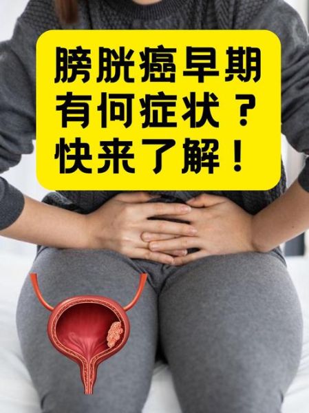 体内有癌的早期症状_如何判断体内有癌-第2张图片-山城妙识