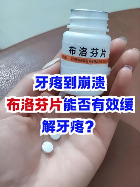 牙疼吃什么药好使_牙疼吃什么药止痛最快-第1张图片-山城妙识