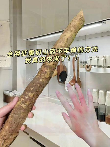 切淮山手痒怎么办_淮山痒手快速止痒方法-第1张图片-山城妙识