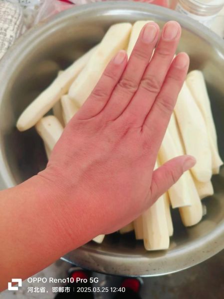 切淮山手痒怎么办_淮山痒手快速止痒方法-第3张图片-山城妙识