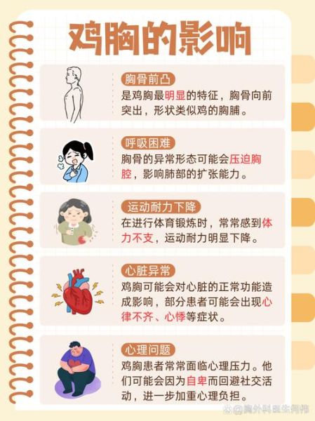 青少年鸡胸图片_鸡胸怎么矫正-第2张图片-山城妙识