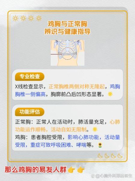 青少年鸡胸图片_鸡胸怎么矫正-第3张图片-山城妙识