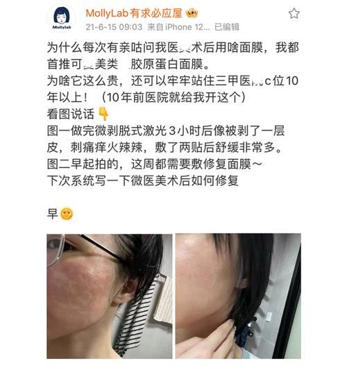 蛋清面膜的危害_蛋清面膜会烂脸吗-第2张图片-山城妙识