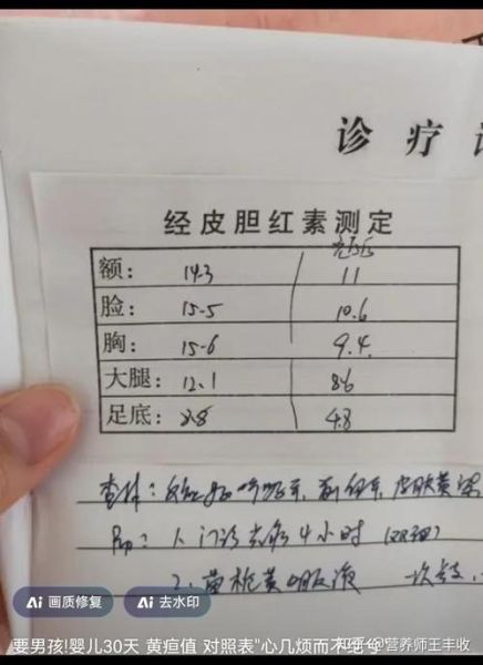 橘子吃多了皮肤会变黄吗_胡萝卜素血症多久能退-第3张图片-山城妙识