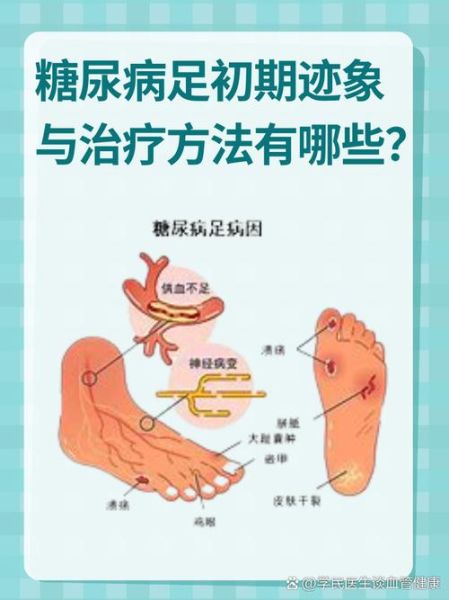 糖尿病前兆五个信号_如何早发现-第2张图片-山城妙识