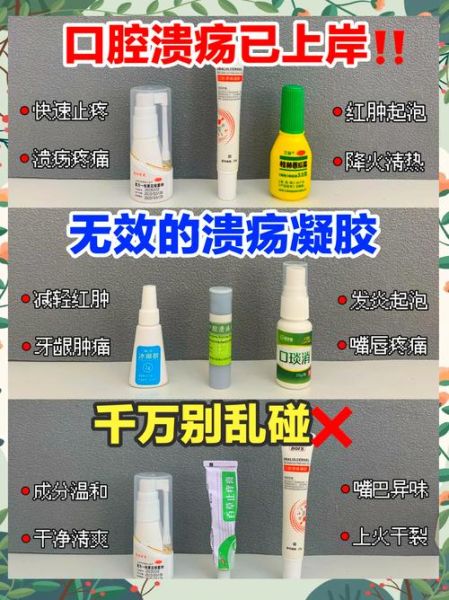 口腔溃疡怎么快速好_一夜治愈妙法的真相-第1张图片-山城妙识