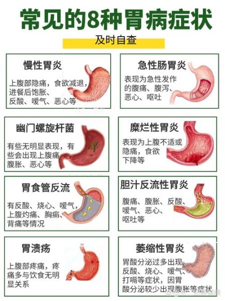女性胃癌前期五个身体信号_早期有哪些症状-第1张图片-山城妙识