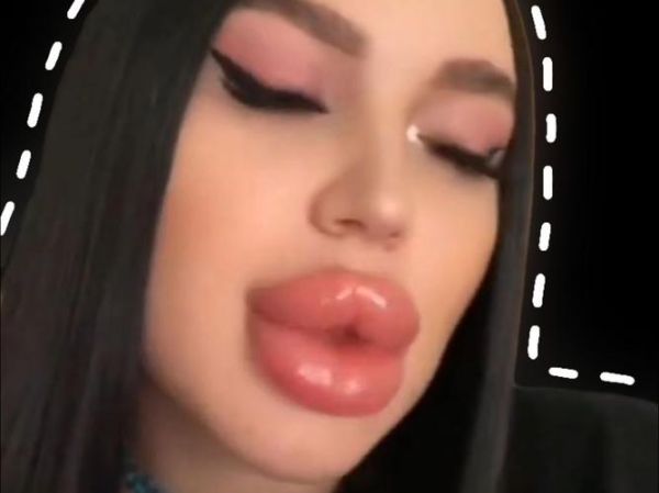 香肠嘴图片女丑_香肠嘴女生怎么改善-第1张图片-山城妙识