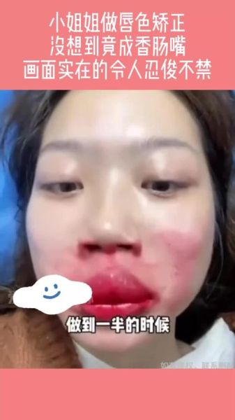 香肠嘴图片女丑_香肠嘴女生怎么改善-第2张图片-山城妙识