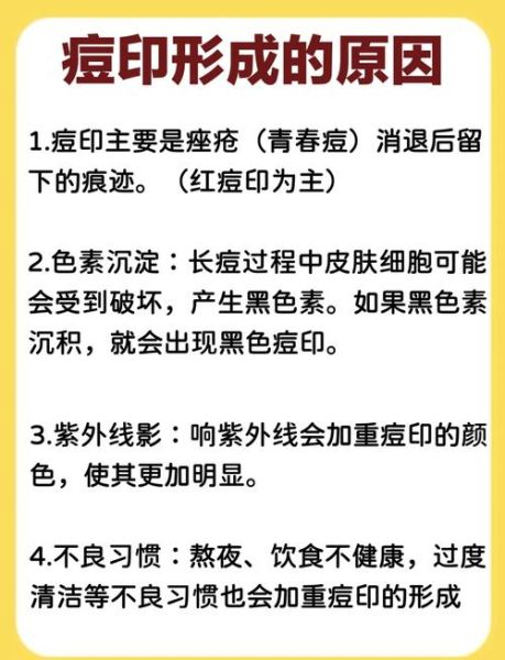 学生祛痘方法3天见效_学生祛痘最简单的方法-第1张图片-山城妙识