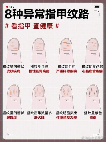 健康状况分为哪四类_如何快速判断自己属于哪一类-第3张图片-山城妙识