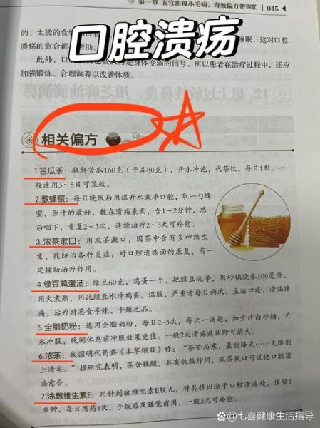 口腔溃疡怎么办_民间偏方真的有效吗-第1张图片-山城妙识