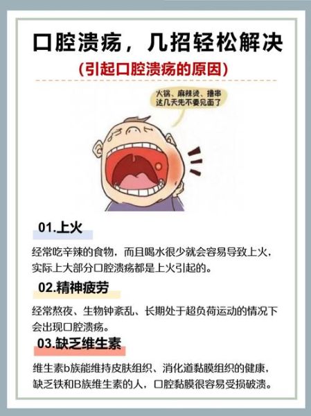 口腔溃疡怎么办_民间偏方真的有效吗-第3张图片-山城妙识