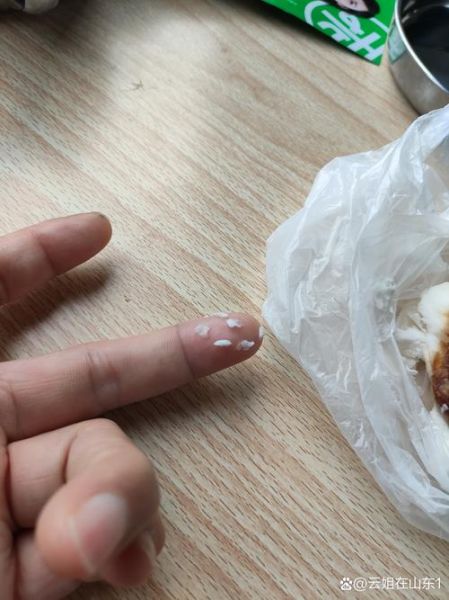 叉烧包事件真相_叉烧包事件影响-第1张图片-山城妙识