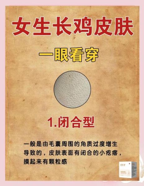 鸡皮肤怎么消除最有效_手臂鸡皮肤怎么改善-第2张图片-山城妙识