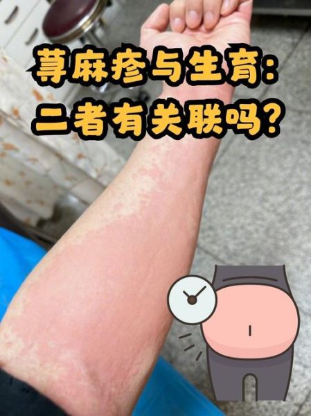 皮肤过敏症状图片_怎么判断是不是过敏-第2张图片-山城妙识