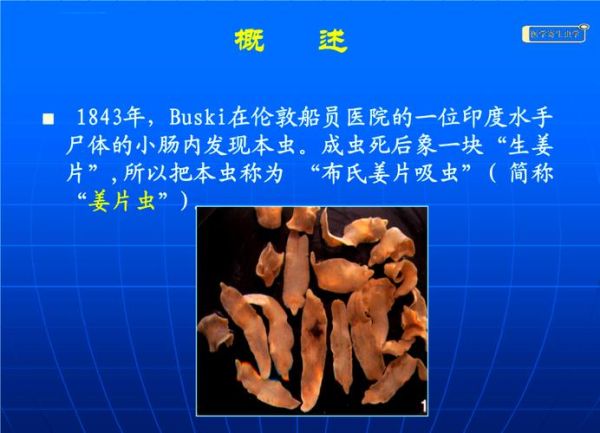 姜片虫寄生在人体的什么部位_感染后有哪些症状-第3张图片-山城妙识 姜片虫寄生在人体的什么部位_感染后有哪些症状-第3张图片-山城妙识