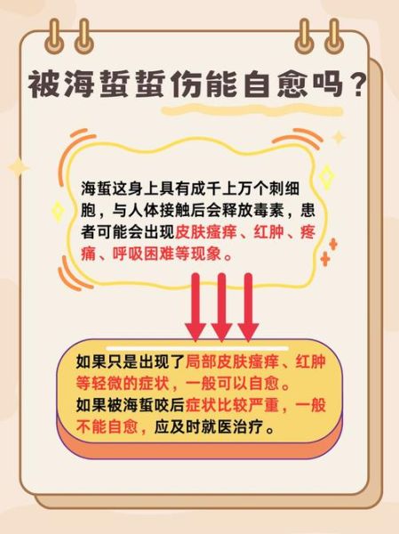 海蜇蜇人后怎么处理_海蜇蜇伤多久能好-第2张图片-山城妙识