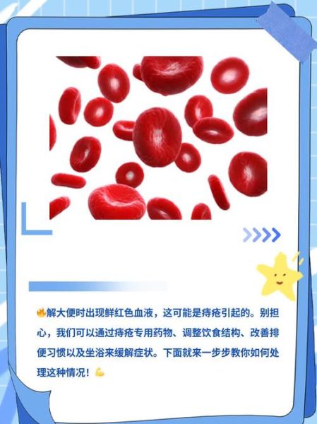 大便出血鲜红色不痛不痒怎么回事_需要看医生吗-第1张图片-山城妙识