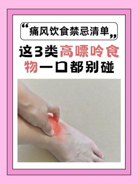 痛风不能吃什么食物_痛风忌口食物明细-第2张图片-山城妙识