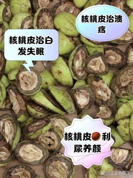薄皮核桃的功效与作用_孕妇能吃薄皮核桃吗-第1张图片-山城妙识