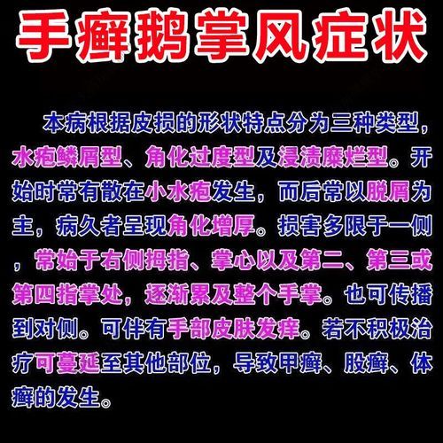 鹅掌风怎么治疗_鹅掌风用什么药好-第1张图片-山城妙识