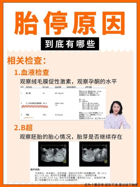 孕妈哪些行为会导致胎停_胎停育的真正原因-第2张图片-山城妙识