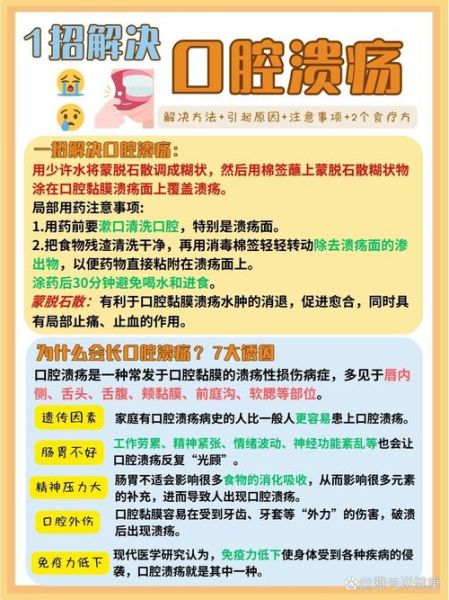 口腔溃疡怎么快速止痛_口腔溃疡止痛小妙招-第1张图片-山城妙识