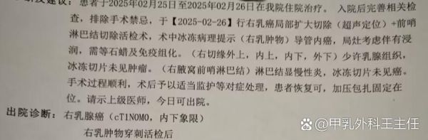 乳腺癌的早期症状有哪些_如何自查发现异常-第2张图片-山城妙识
