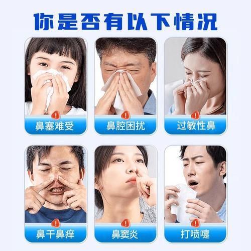 贻贝粘蛋白鼻腔喷雾有用吗_贻贝粘蛋白鼻腔喷雾副作用-第1张图片-山城妙识 贻贝粘蛋白鼻腔喷雾有用吗_贻贝粘蛋白鼻腔喷雾副作用-第1张图片-山城妙识