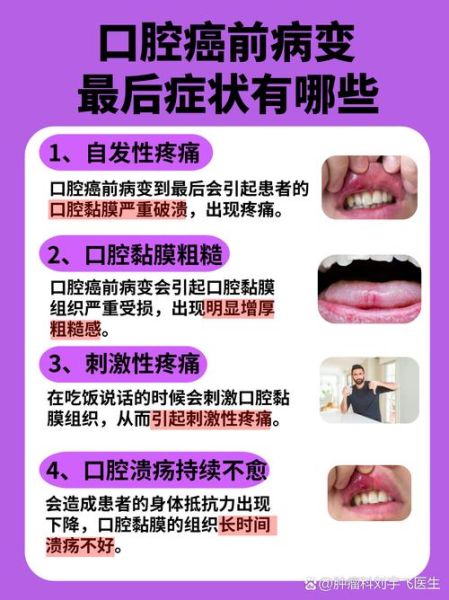 口腔溃疡反复不愈_警惕口腔癌前病变-第1张图片-山城妙识 口腔溃疡反复不愈_警惕口腔癌前病变-第1张图片-山城妙识